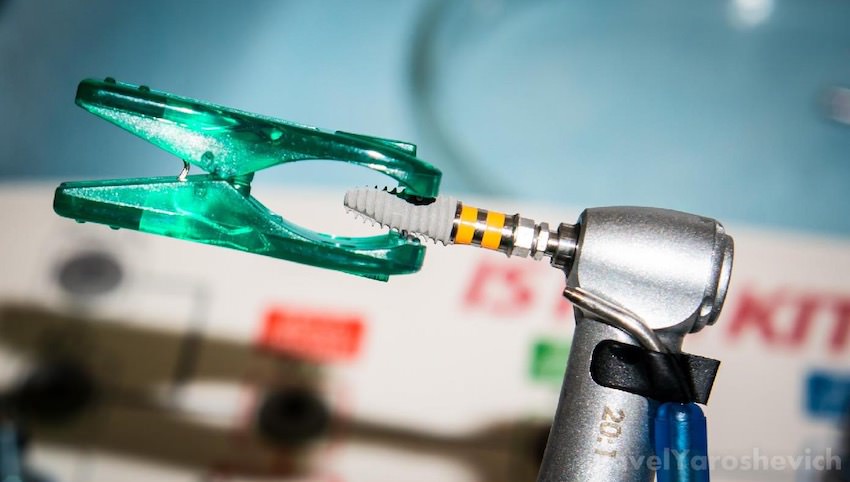 Имплантат NeoBiotech IS II Active | НеоБиотек ИС2